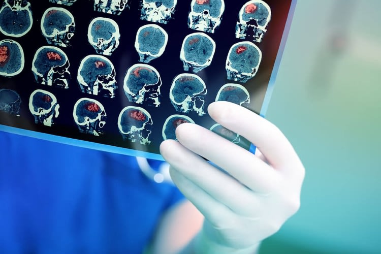 Neurologists in CT | Stamford Health Neurology