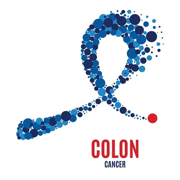 Colon Cancer Screening: How Often Should You Get A Colonoscopy ...