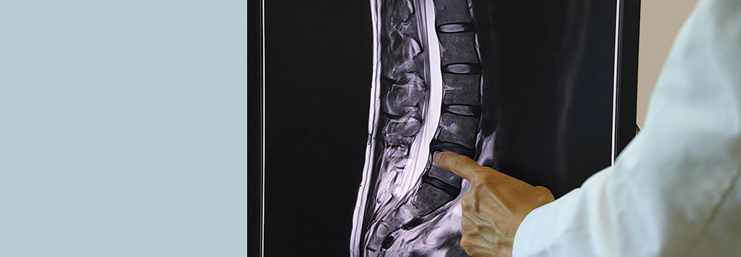 HSS Spine Center | Orthopedic Care in CT | Stamford Health