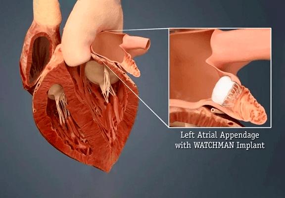 Cardiologists & Heart Care near Stamford, CT | Stamford Health